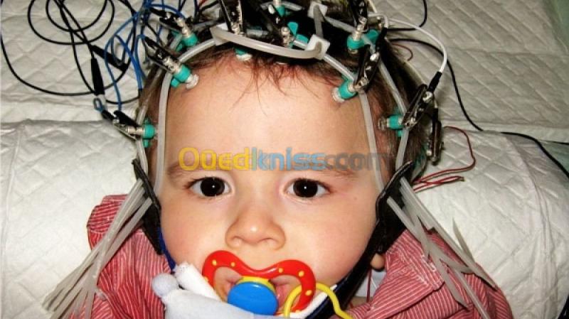 Electro-encéphalogramme (EEG) Blida Blida - Ouedkniss.com - Algérie